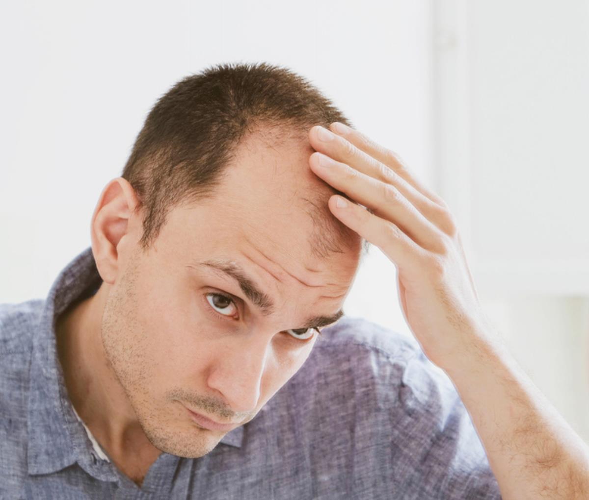 Alopecia y caída del cabello: causas, prevención y tratamientos ...